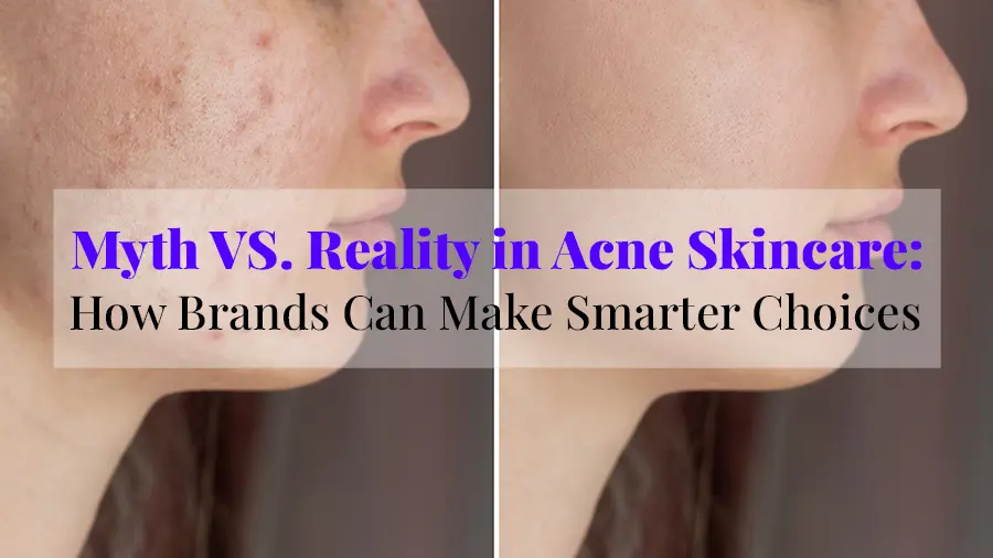 Myth VS. Reality in Acne Skincare: How Brands Can Make Smarter Choices